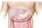 Angioma epatico, cos'è, quali sono i suoi sintomi e cosa prevede il ...